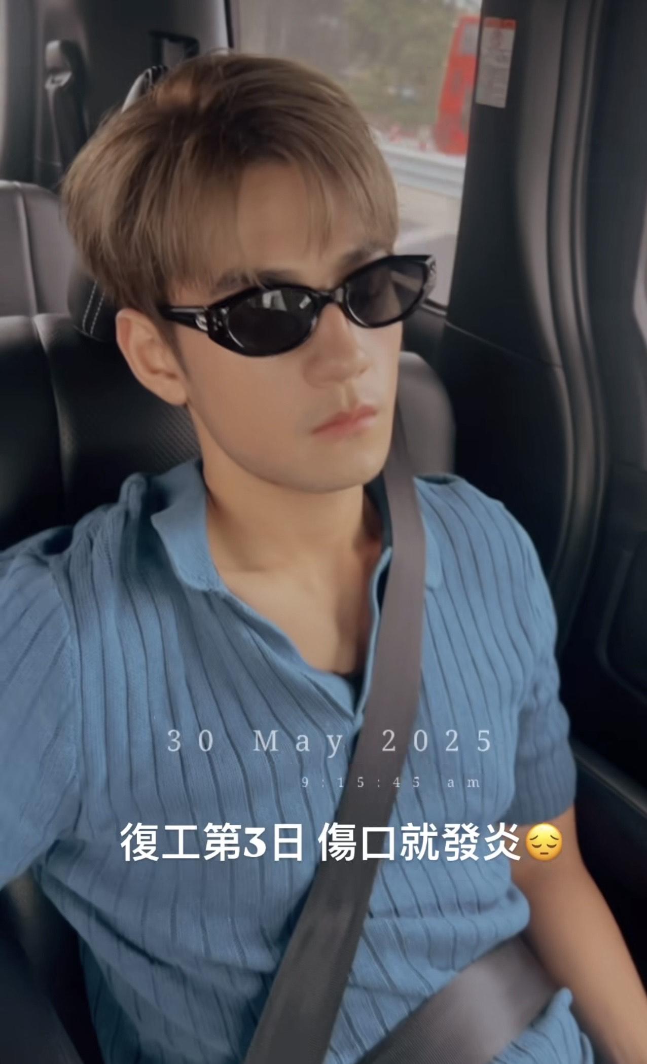 Jeffrey魏浚笙不顧頸傷密密出騷吸金 冇晒心機透露傷口發炎 | am730 | am730