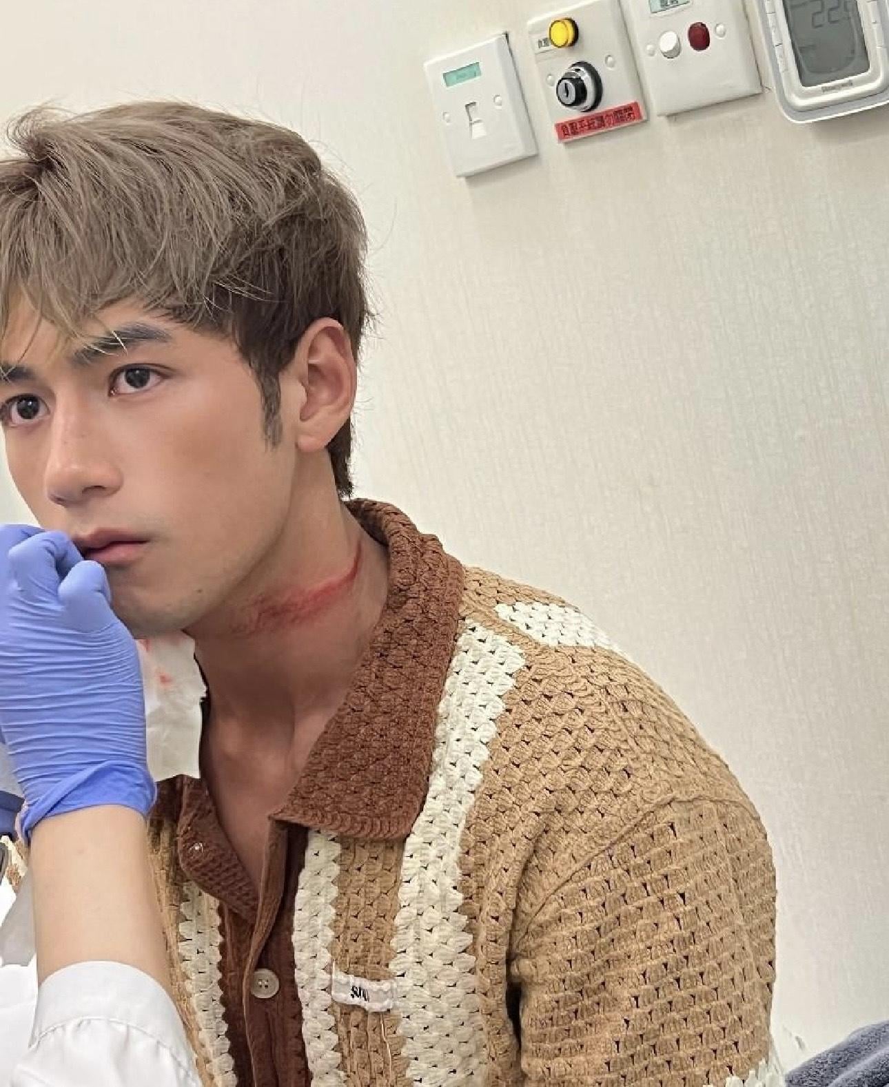 Jeffrey魏浚笙不顧頸傷密密出騷吸金 冇晒心機透露傷口發炎 | am730 | am730