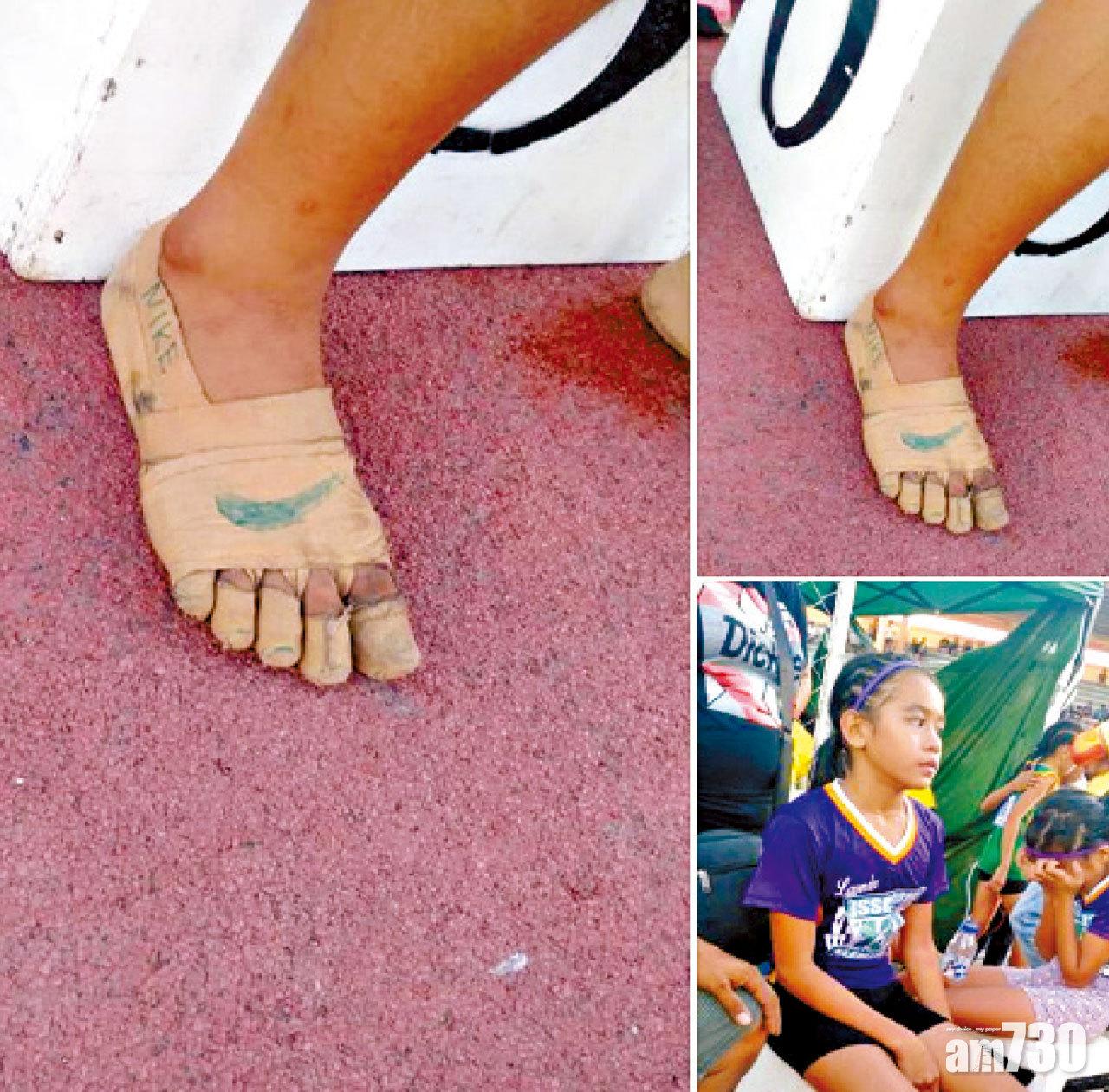 菲女童繃帶製NIKE跑鞋 網民心酸 | am730 | am730