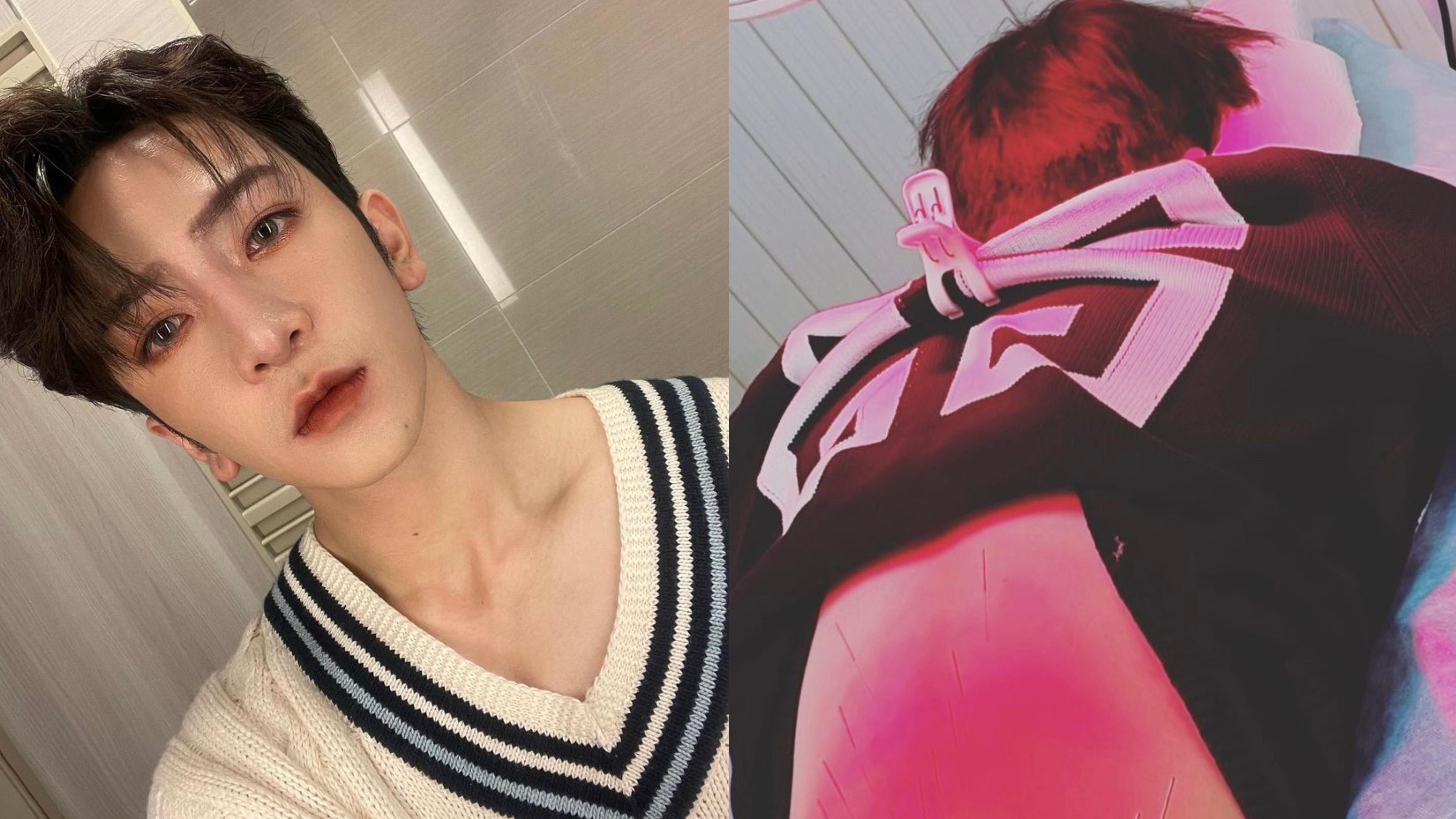 Anson Lo腰部雙腳插滿針接受︰No pain no gain | am730 | am730